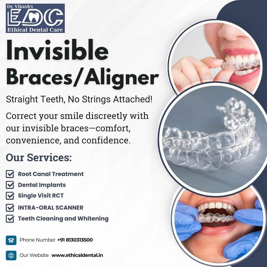 Clear Aligners vs Traditional Braces | Best Orthodontic Treatment